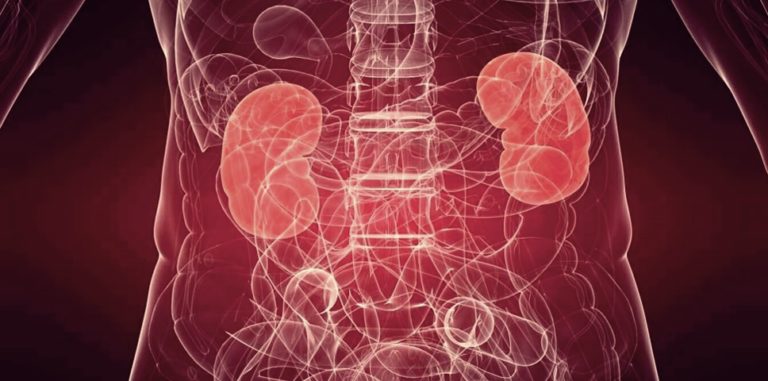 What is a floating kidney?